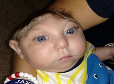 Bebê que nasceu sem parte do cérebro comemora segundo Natal com a ...
